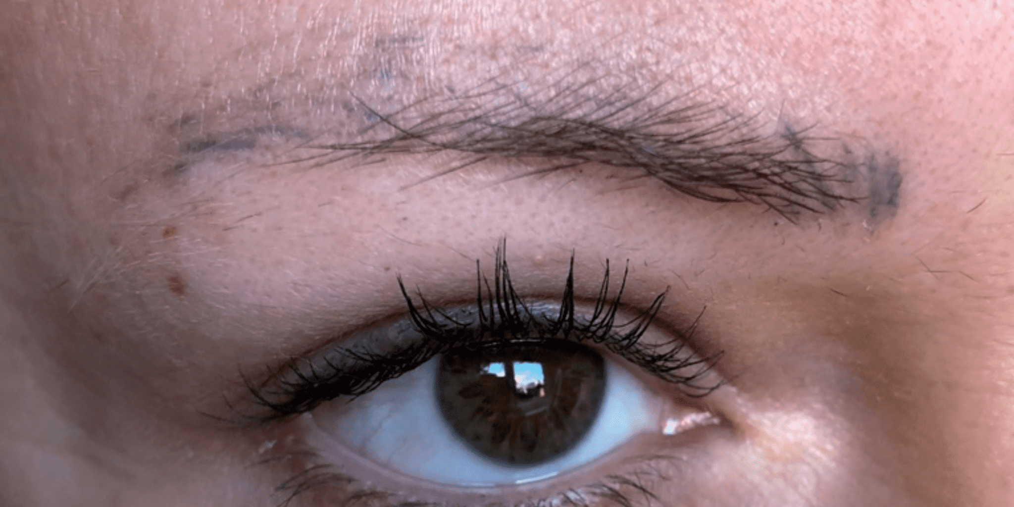 Permanent Makeup: With or Without Anesthesia? - Kwadron PMU